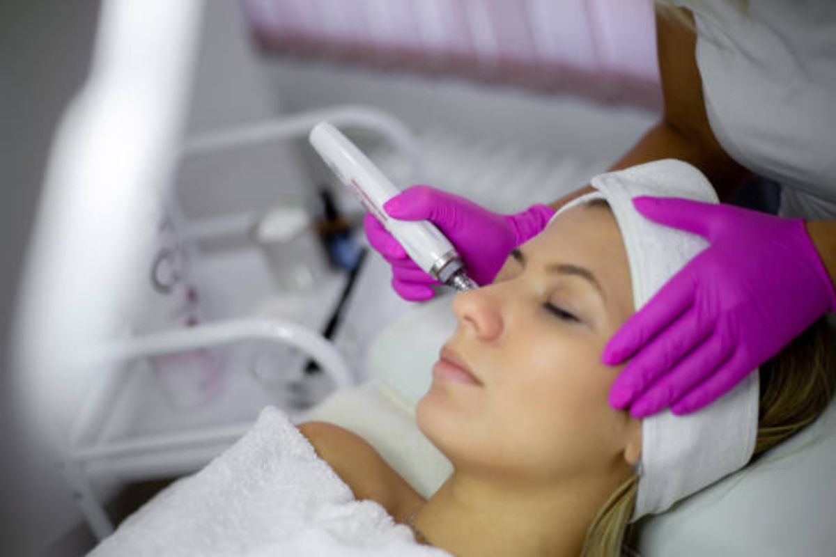 Microneedling vs. Laser Therapy: Choosing the Right Treatment for Your ...